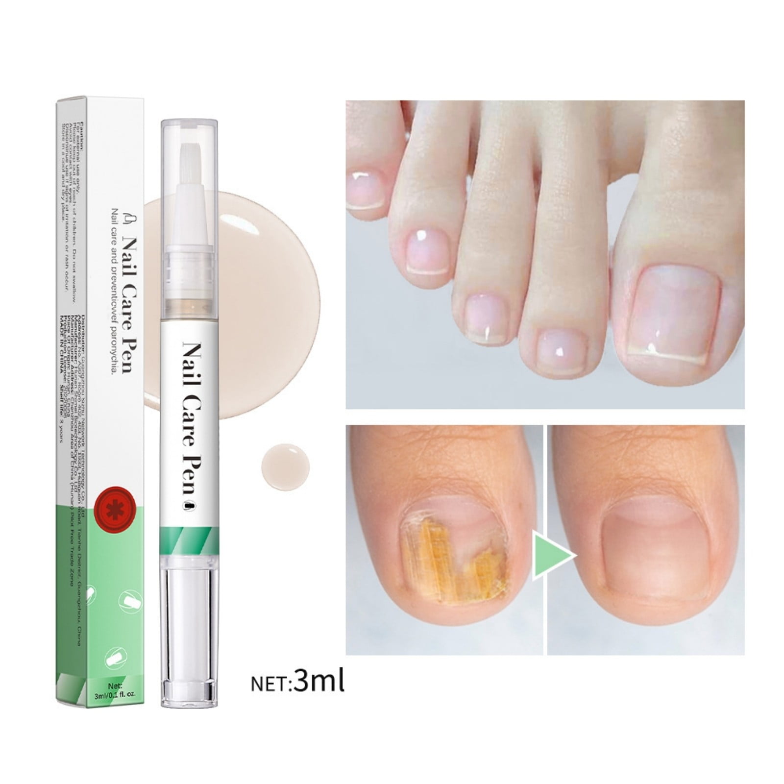 Very Nail Stuff Reusable Nail File Human Nail Grinders For Thick Nails