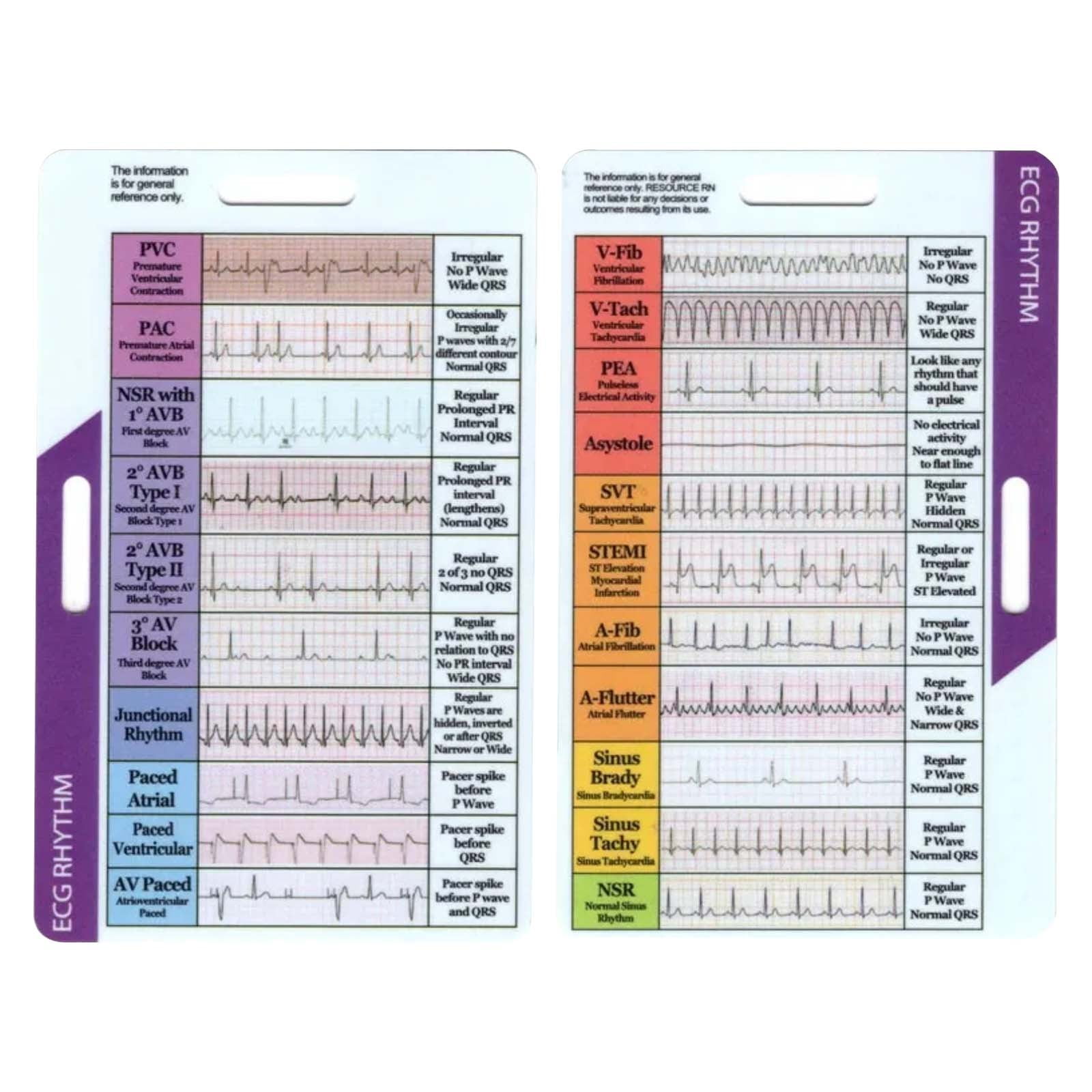 ViLaViDe ECG/EKG Pocket Card: A Quick Reference To Interpreting Heart ...