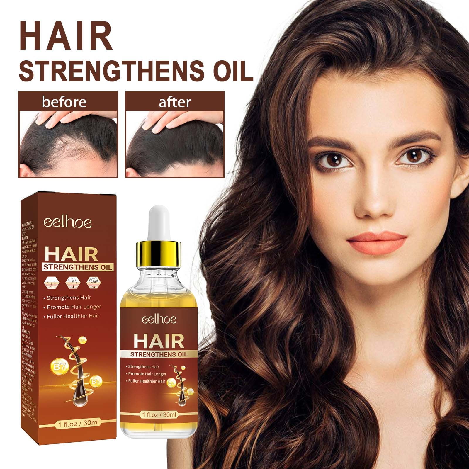 ViYW 30Ml Oil With Biotin And Castor Serum For Thicker Longer Healthier ...