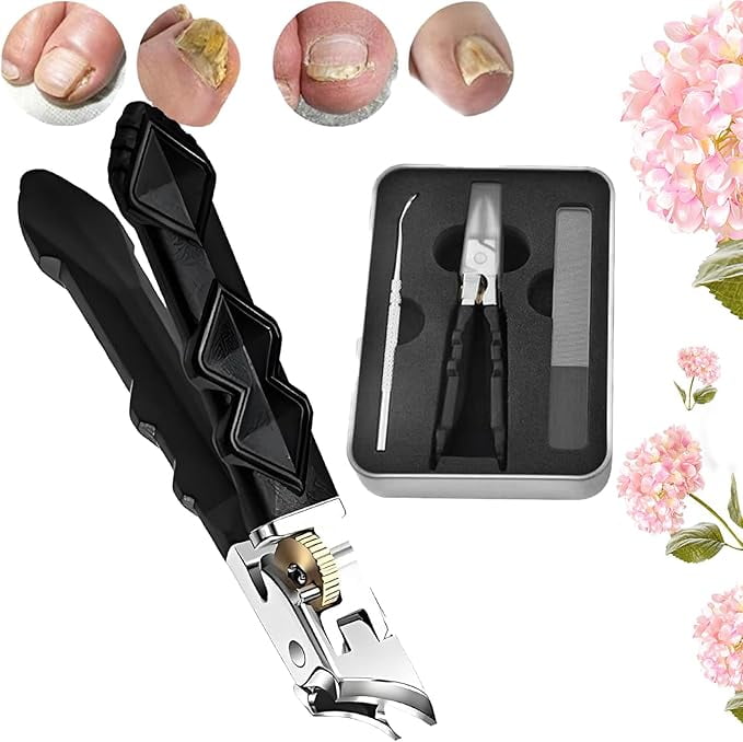 Vianys OrthoClip,Vianys OrthoClip Clipmaster Pro,Graddi/GooWebs OrthoClip Heavy Duty Ingrown ...