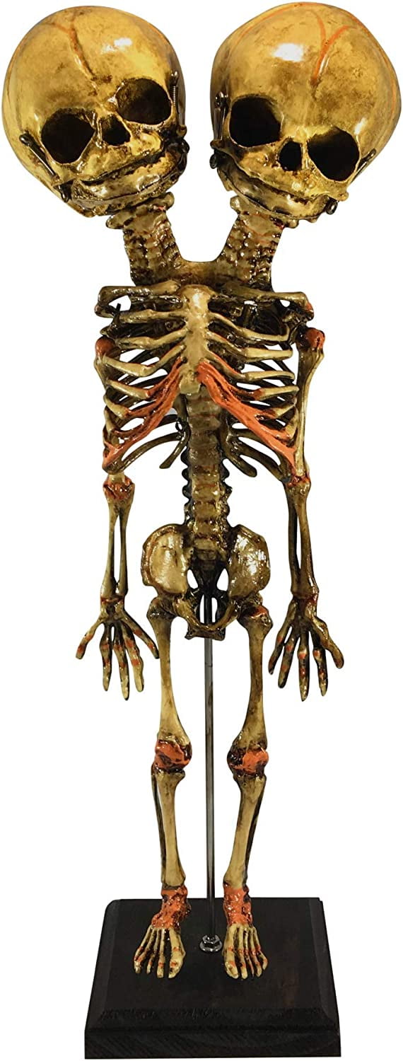 Vintage Deluxe Siamese Twin Fetus Skeleton Fetal Oddity Specimen ...