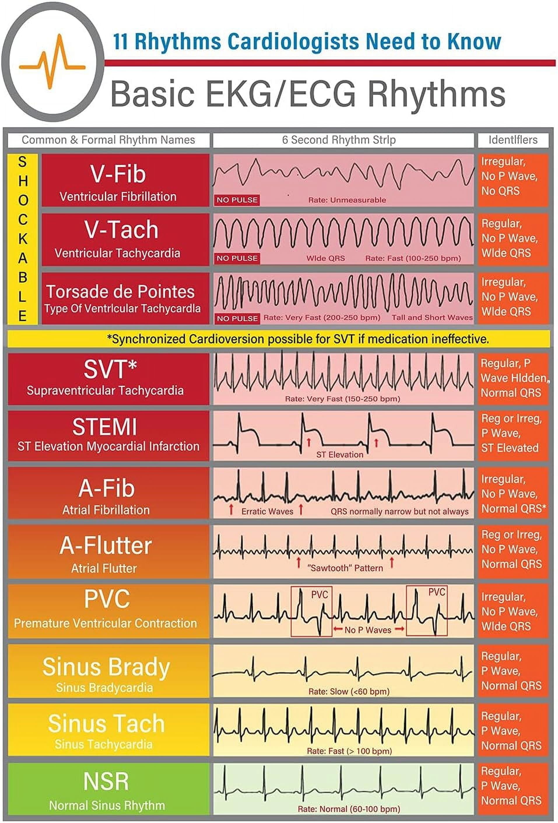 Vintage Tin Sign Cardiology Knowledge Basic EKG ECG Rhythms School ...