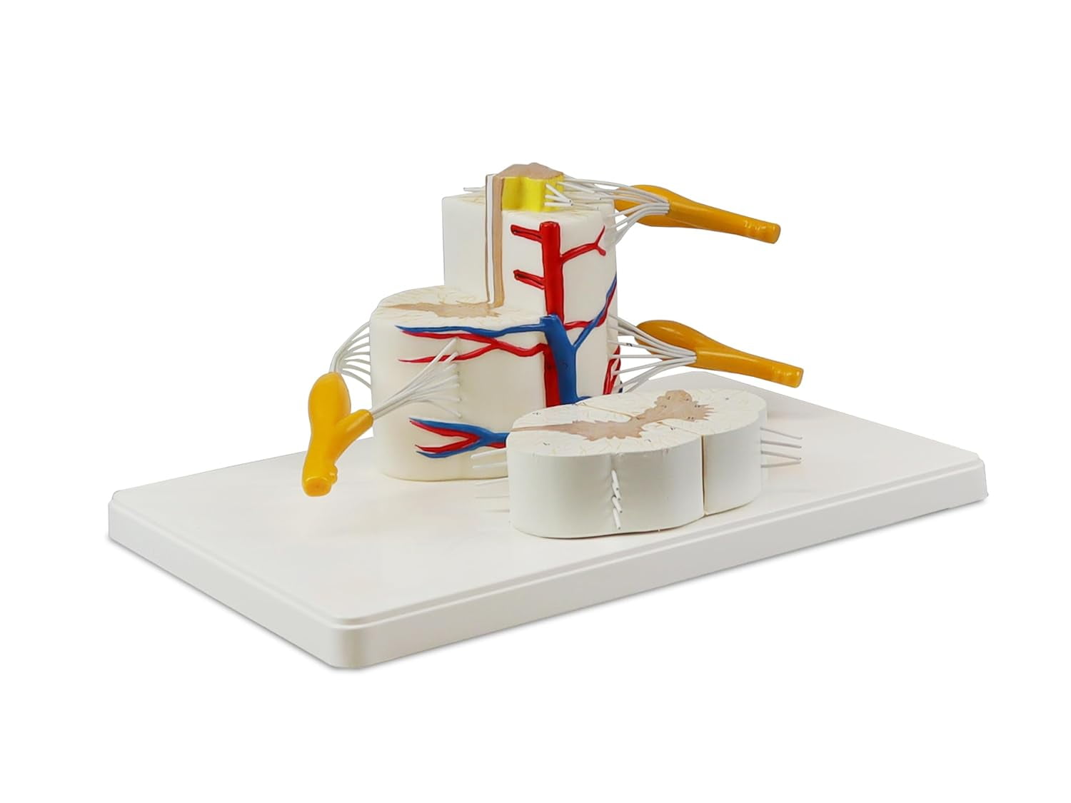 Vision Scientific VAV263 Medical Cross Section Spinal Cord | 2 Parts ...