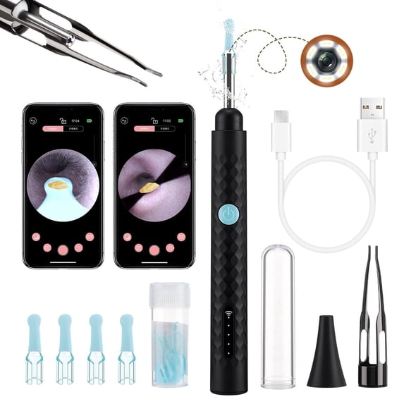 Visual Ear Wax Removal, Ear Cleaner with Camera, Ear Camera Otoscope ...
