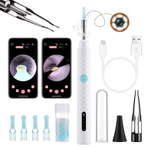 Visual Ear Wax Removal, Ear Cleaner with Camera, Ear Camera Otoscope ...