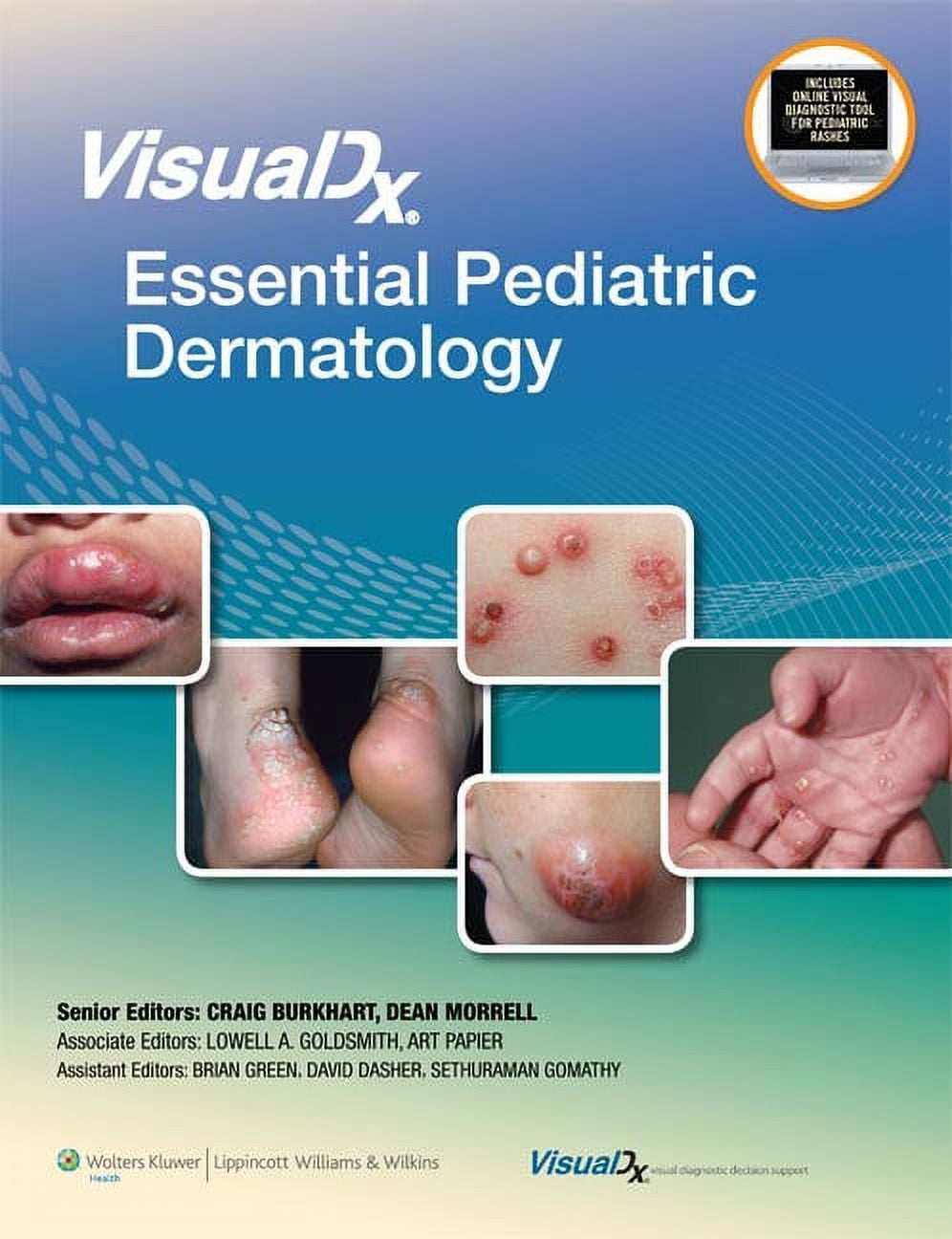 Visualdx: The Modern Library of Visual M Visualdx: Essential Pediatric Dermatology, (Hardcover ...