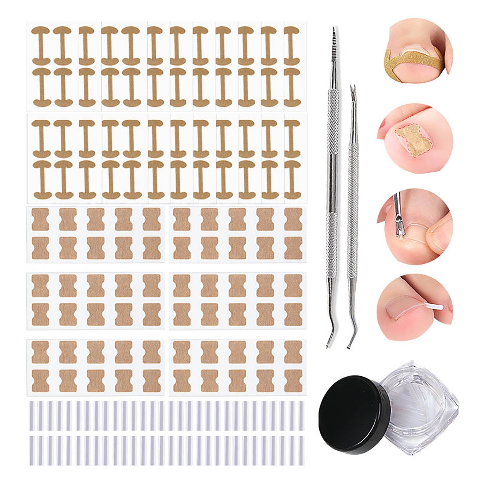 Vrorvz Nail Correction Kit for Paronychia Treatment with 30 Pads 6 Toe ...