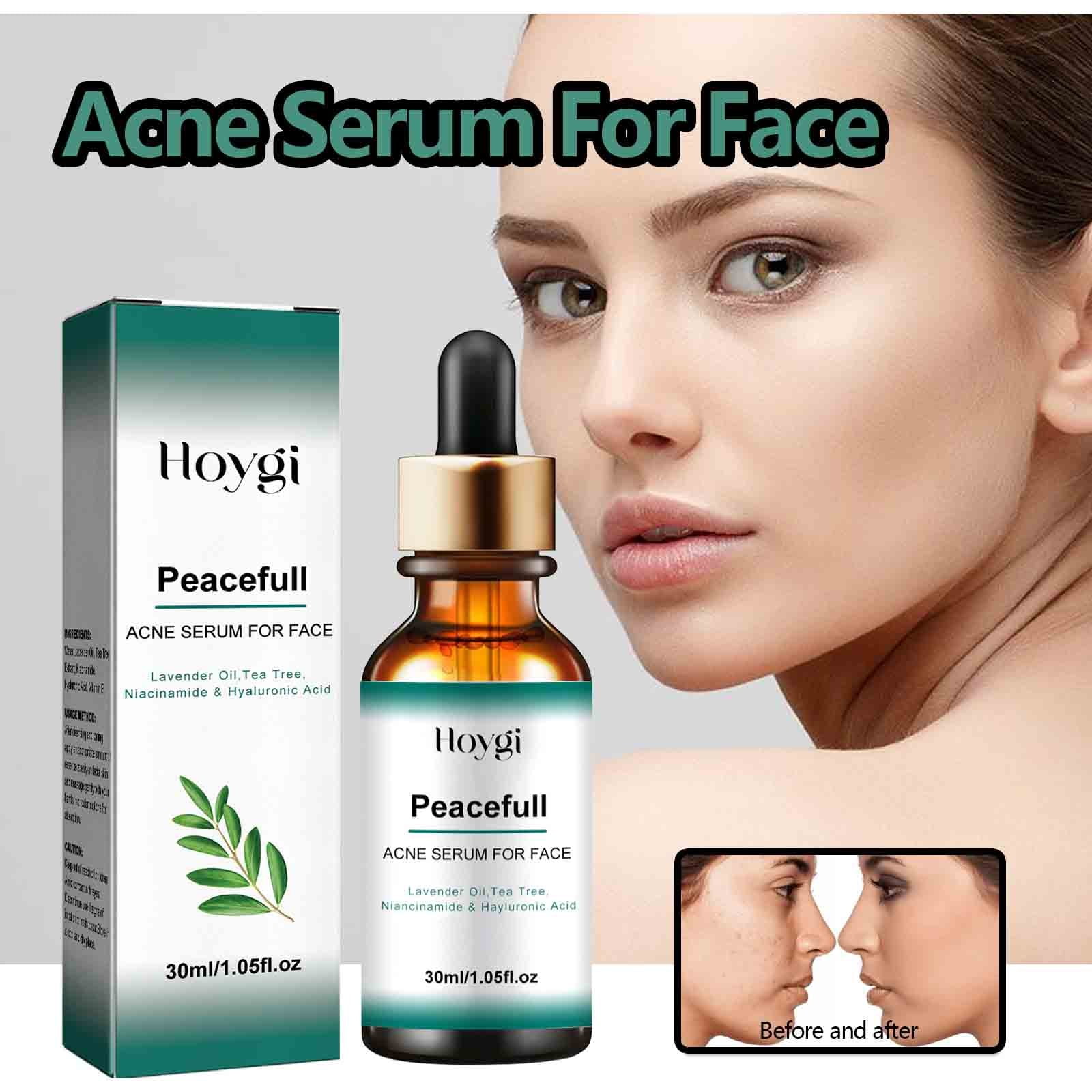 Vrorvz Pore Refining Serum for Clearer Skin,Deeply Hydrates and ...