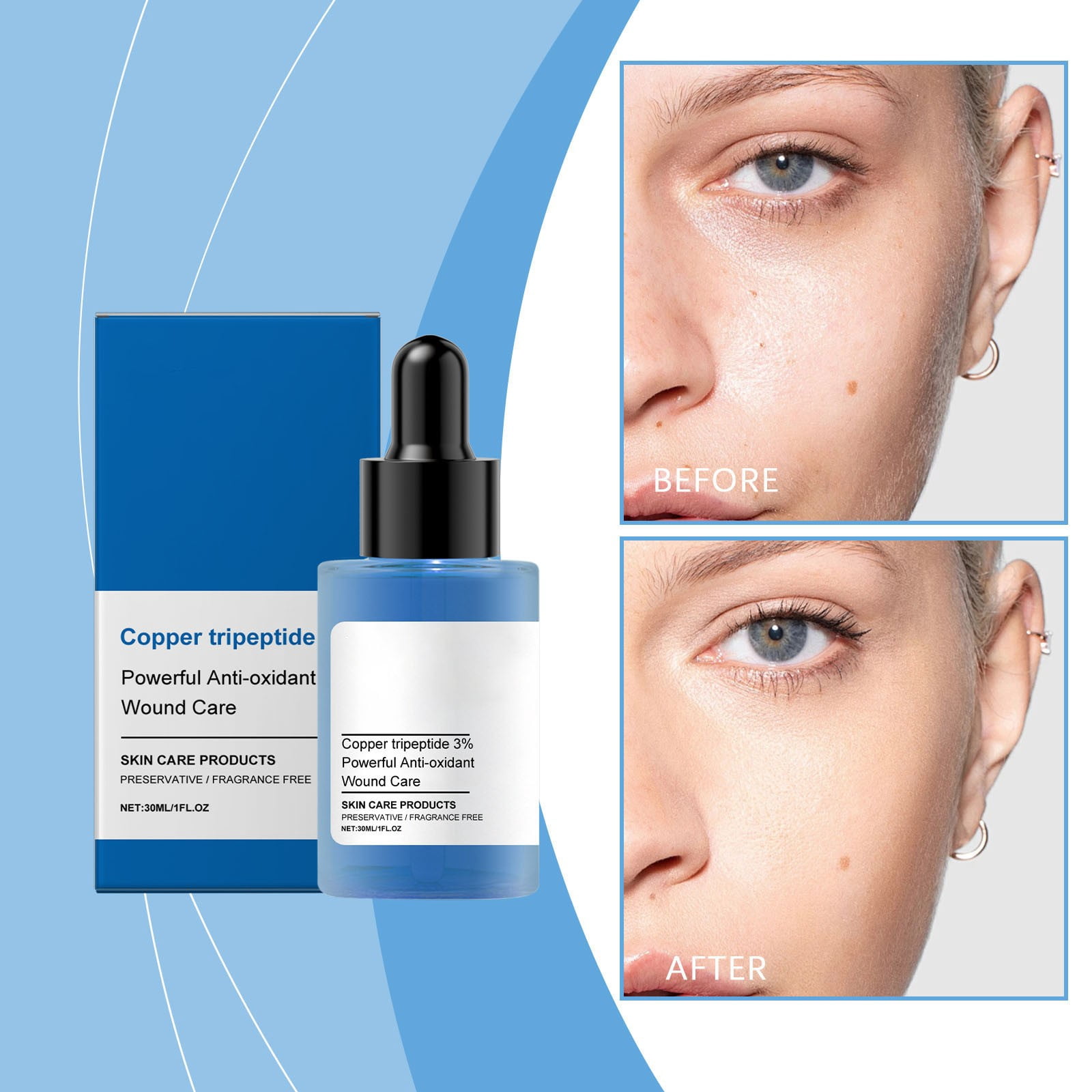 Vrorvz Seabuckthorn Resistant Wrinkle Serum with Hyaluronic Acid for ...