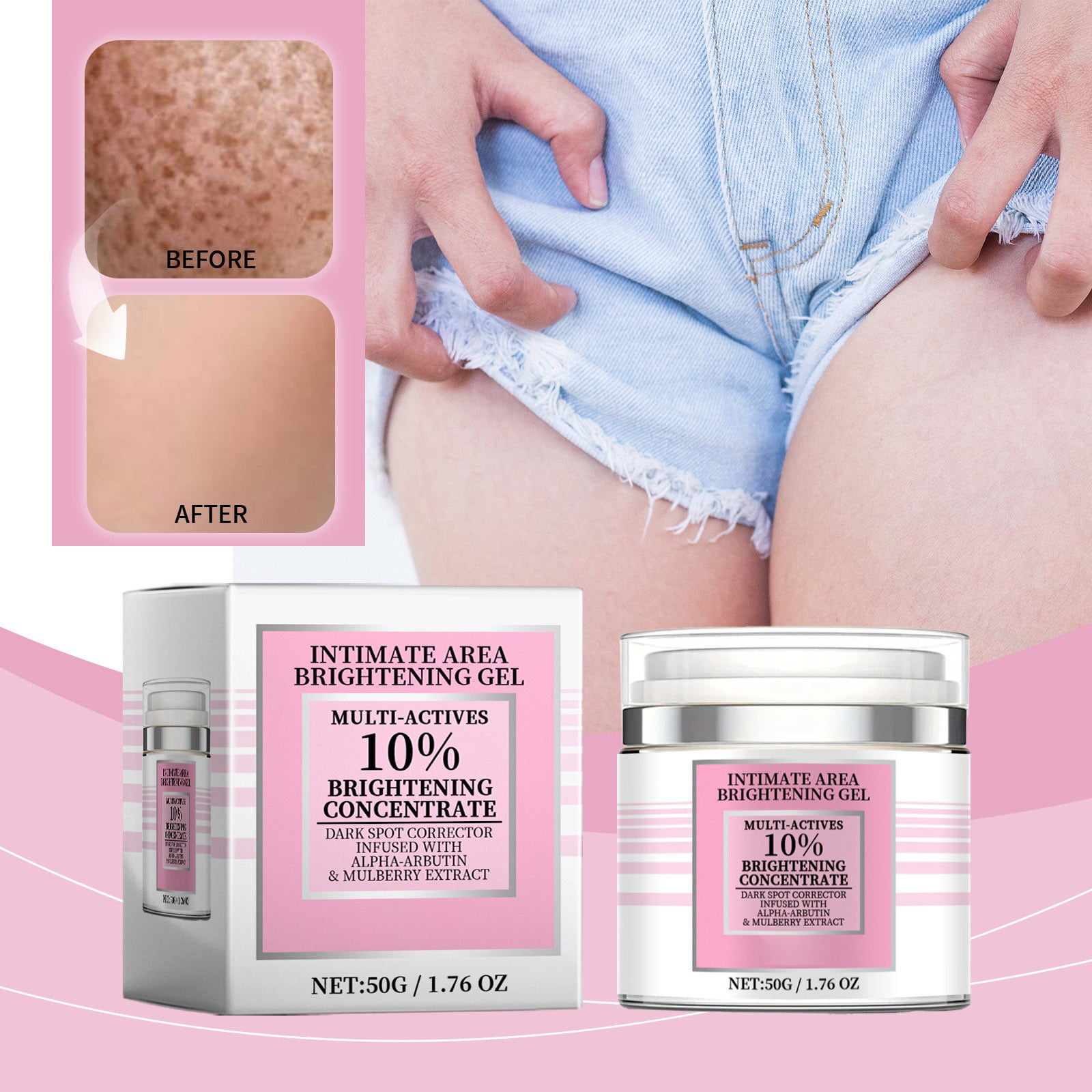 Wangjiaoid Body Blackspot Correction The Body Skin Fades Moisturizes