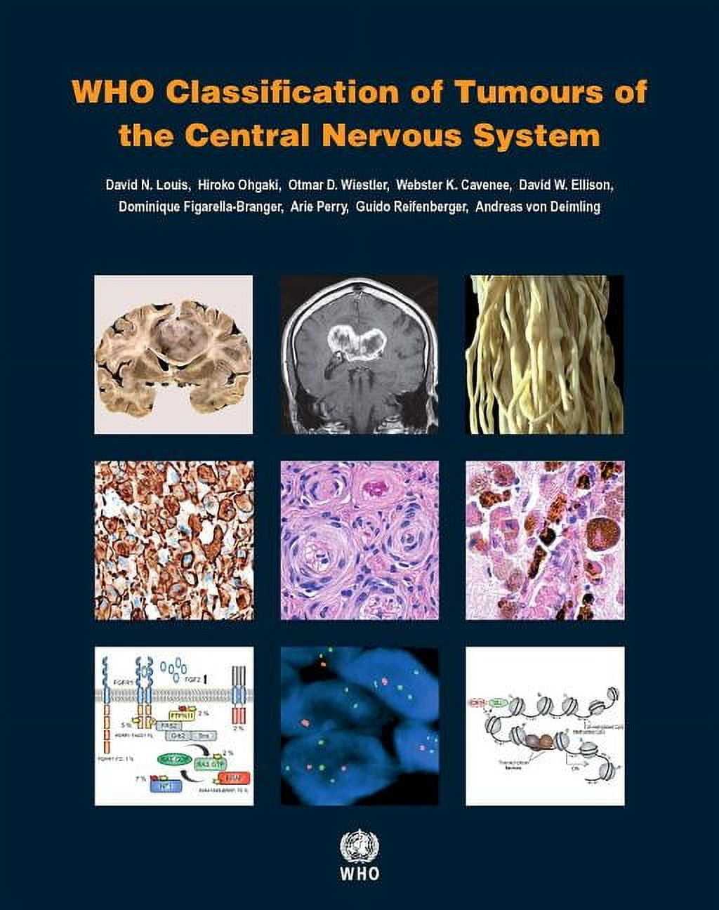 WHO Classification of Tumours: WHO Classification of Tumours of the Central Nervous System ...