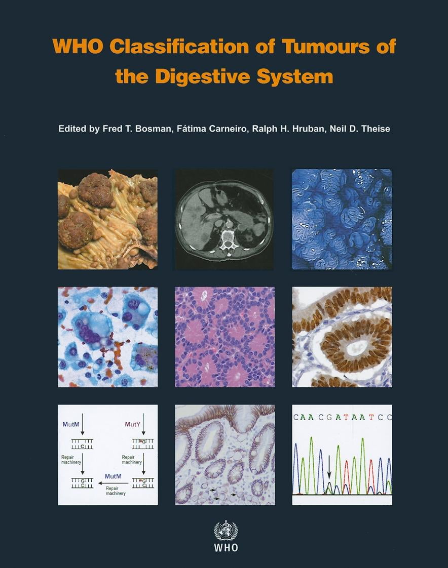 WHO Classification of Tumours of the Digestive System - Walmart.com