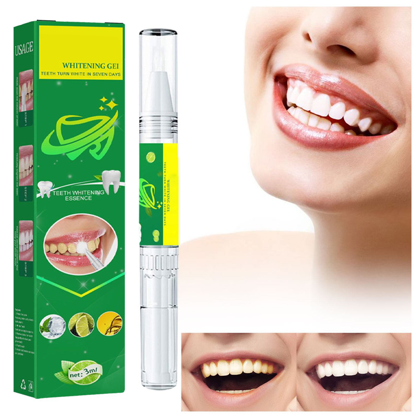 WIFKLSIIPG Pen Tooth Cleaning Care Remove Yellow Teeth Black Stain ...