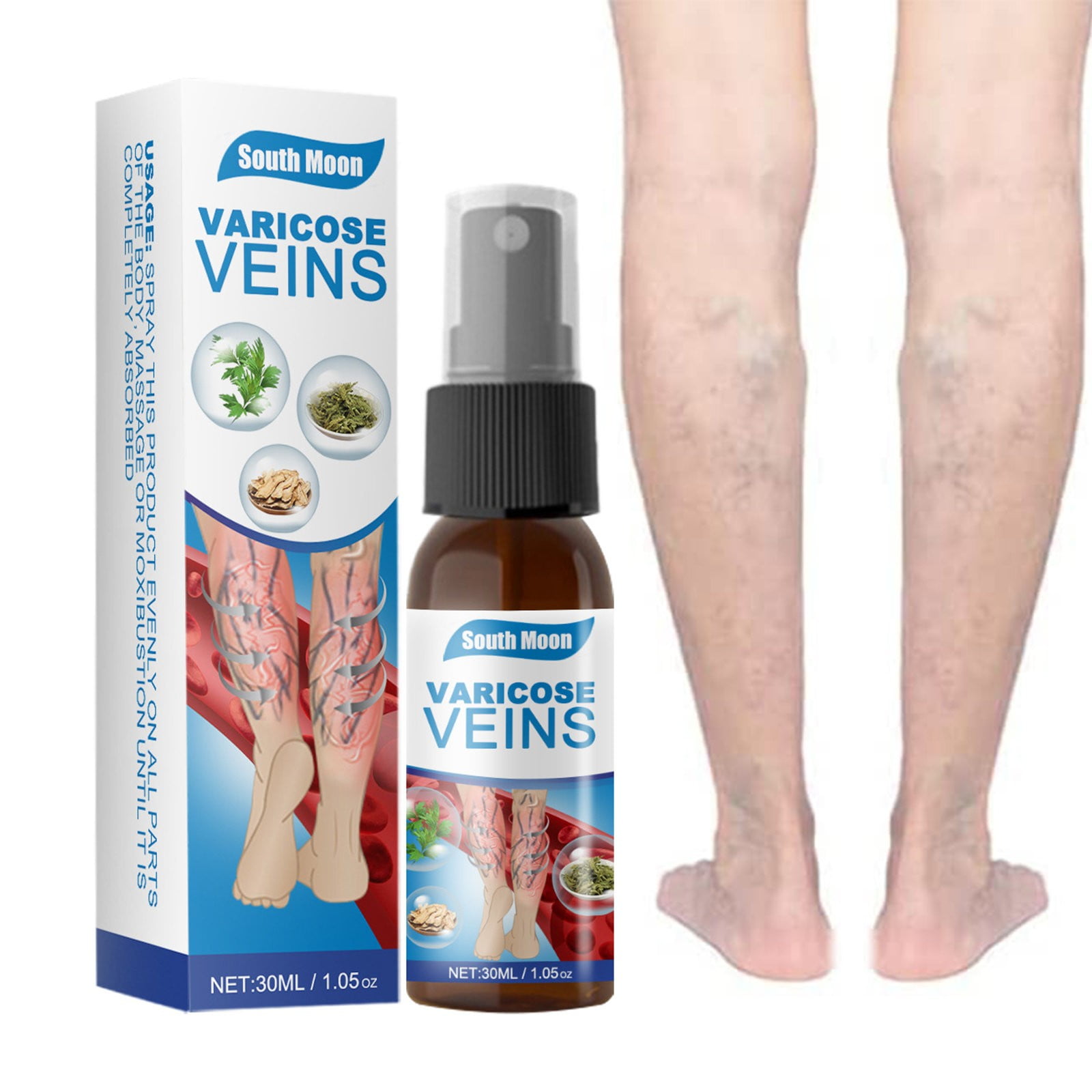 WIFKLSIIPG Veinhealing Varicose Veins Treatment Spray Varicose Veins ...