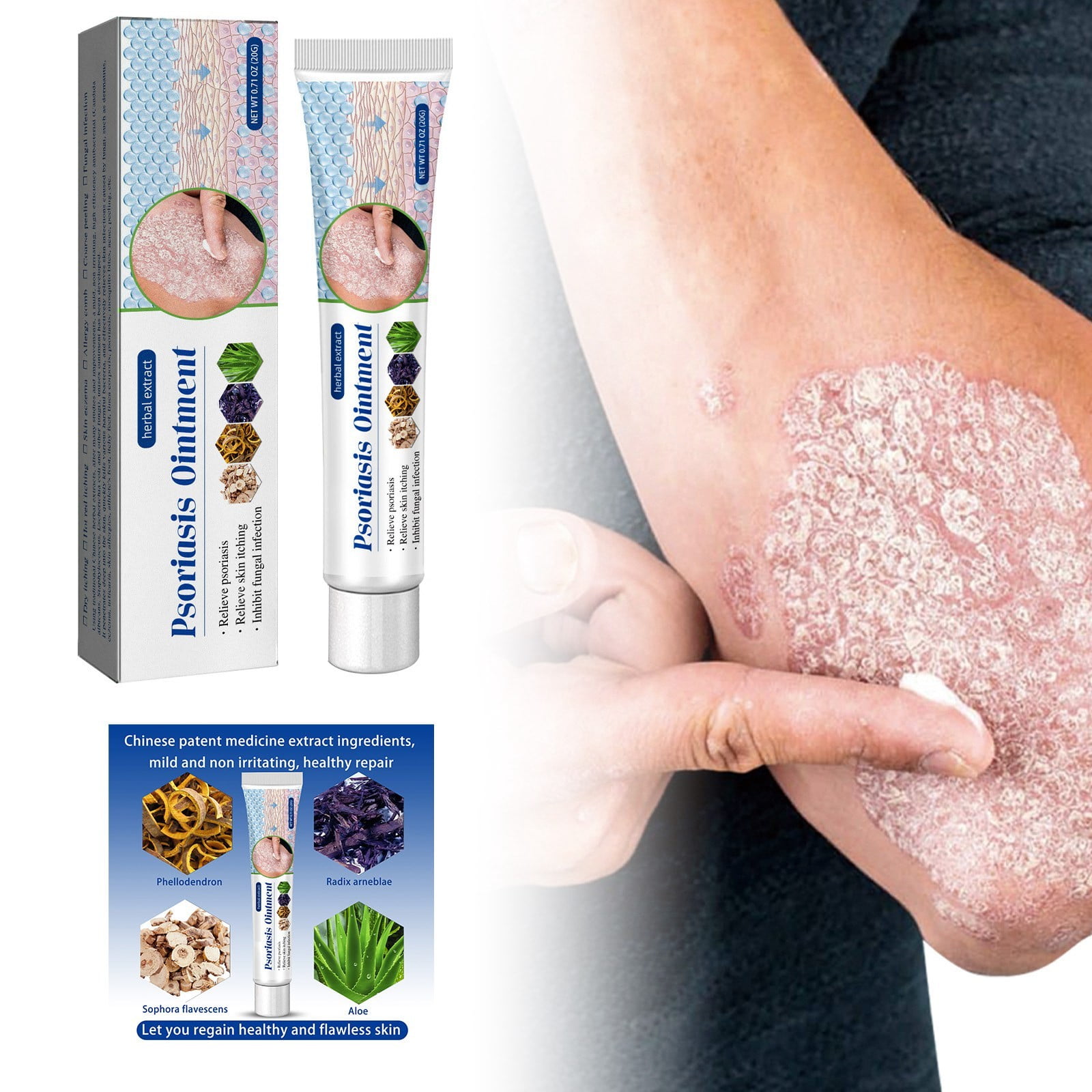 WIQUOKETT Skin Dry and . Moisturizing and Prickly Heat for External Use ...