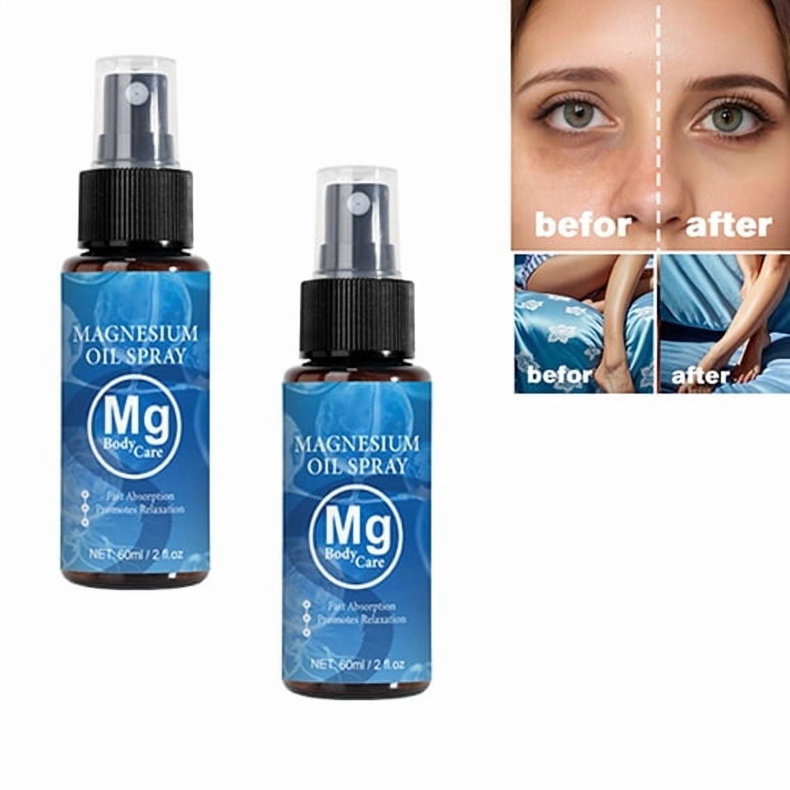 WLDAK Pure Magnesium Oil Spray for Feet - Fast Absorbing Magnesium ...