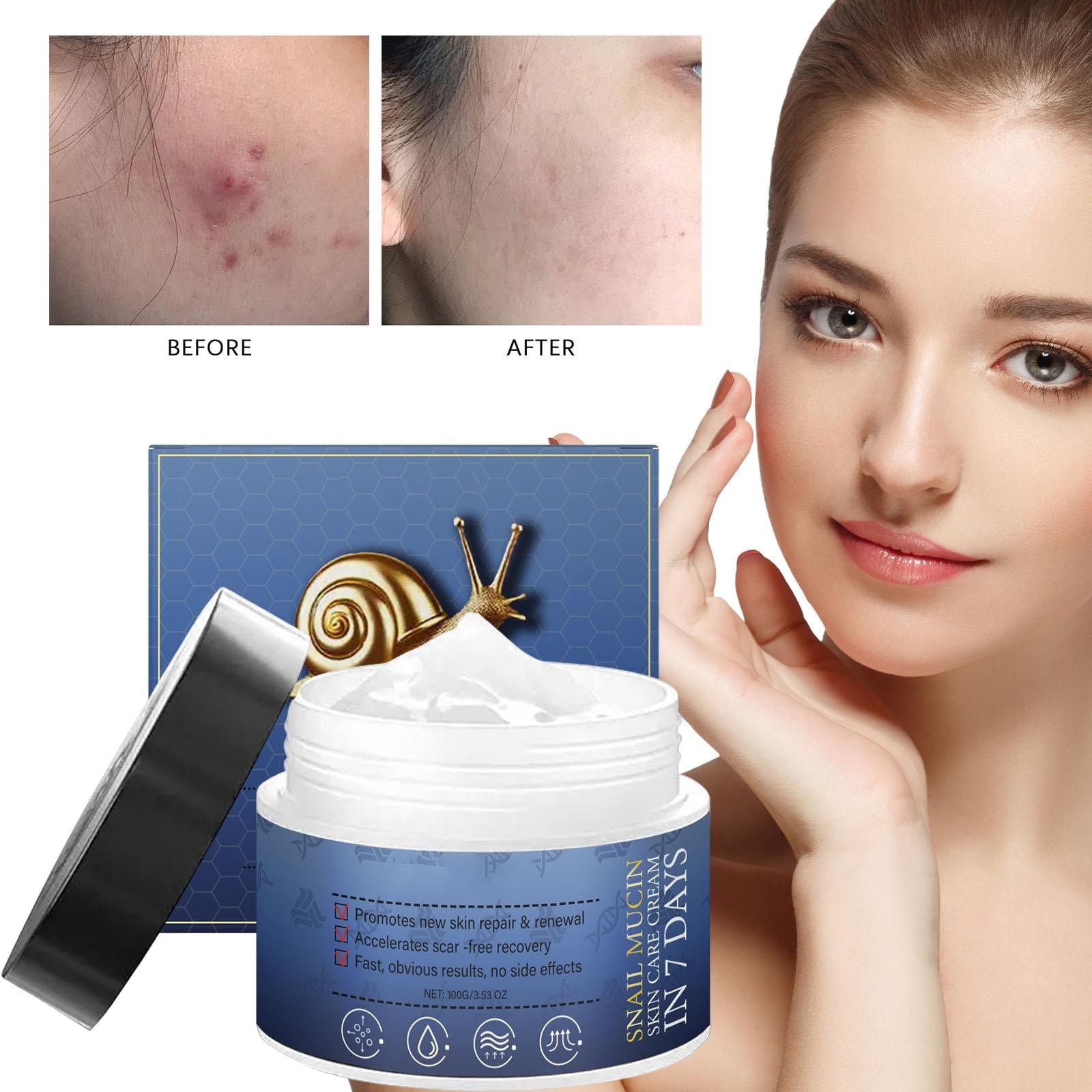 Walmart 2025 Clearance Seurico Mucin Skin 100g.Harnessing The Potency ...