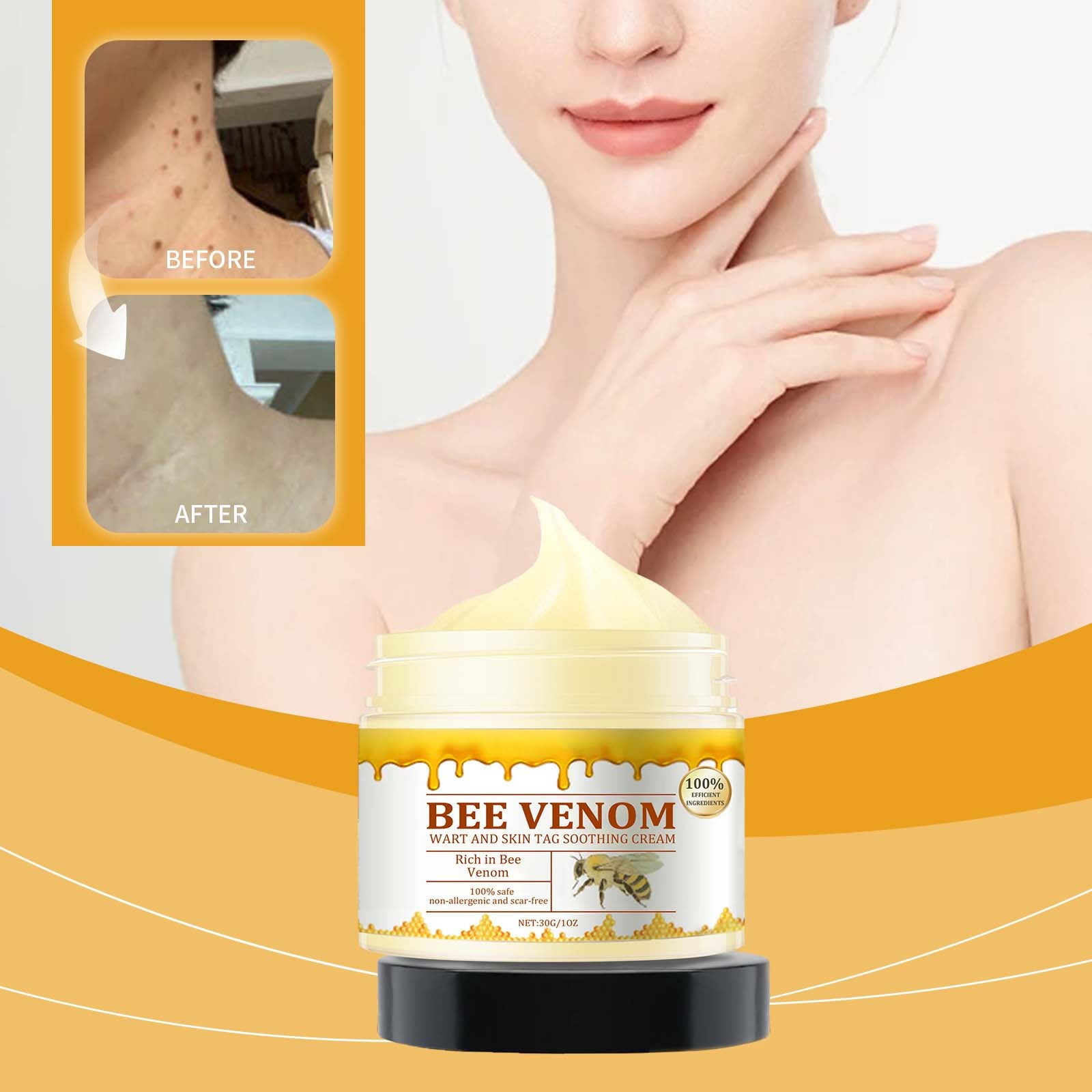 Wart Care Lubricating And Tender Skin Wart And Removal Skin Smoothing ...