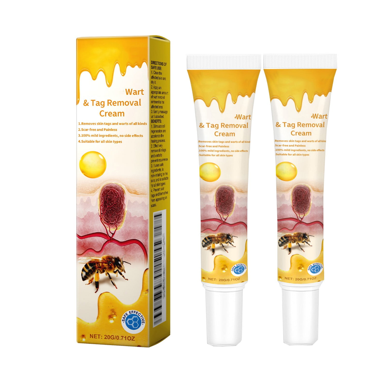 Wart Cream Gram Wart Cream Skin Care Flat Wart Ointment Wart Removal ...