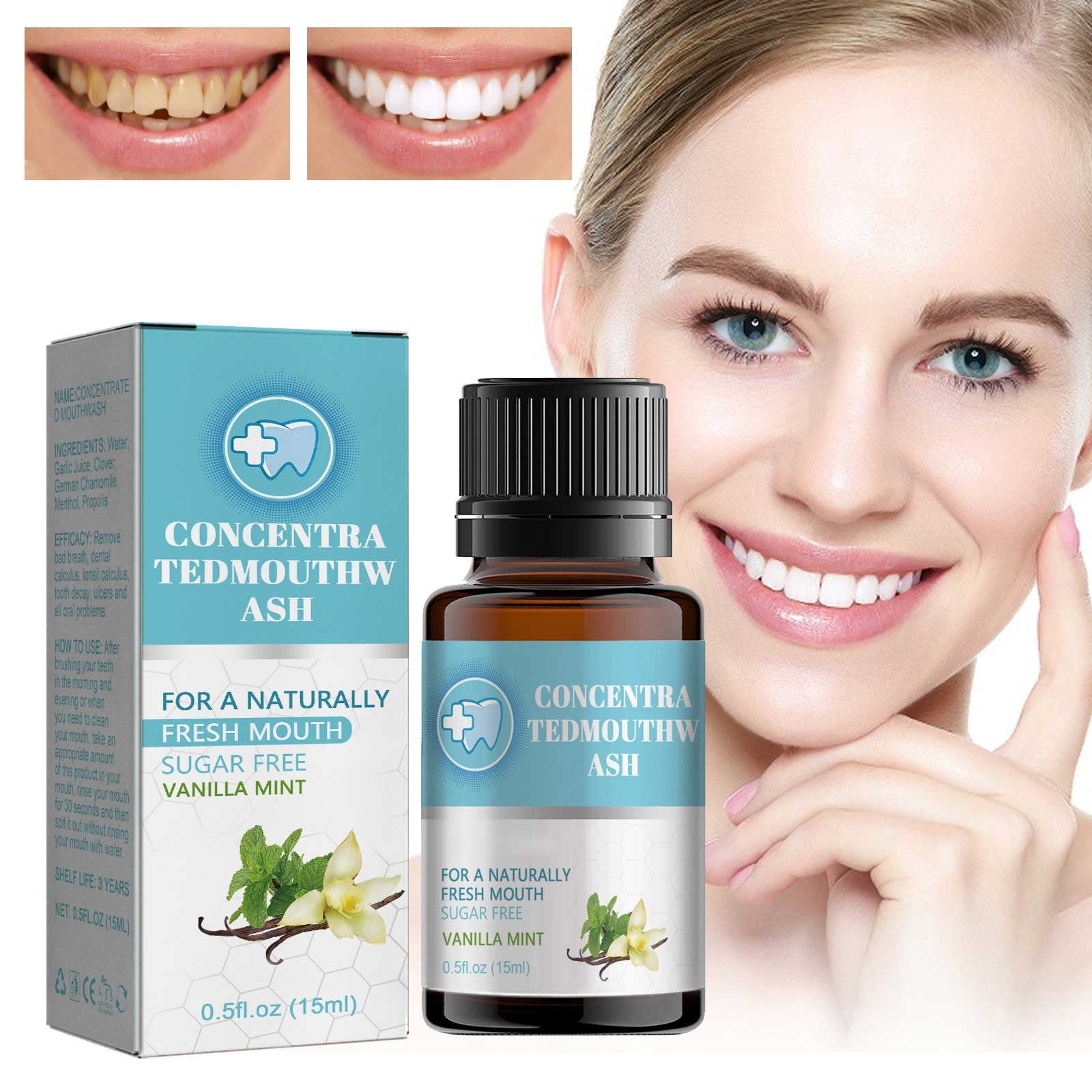 Wash To Bad Yellow Teeth Stain Clean Mouth Fresh And Tooth Mouthwash ...