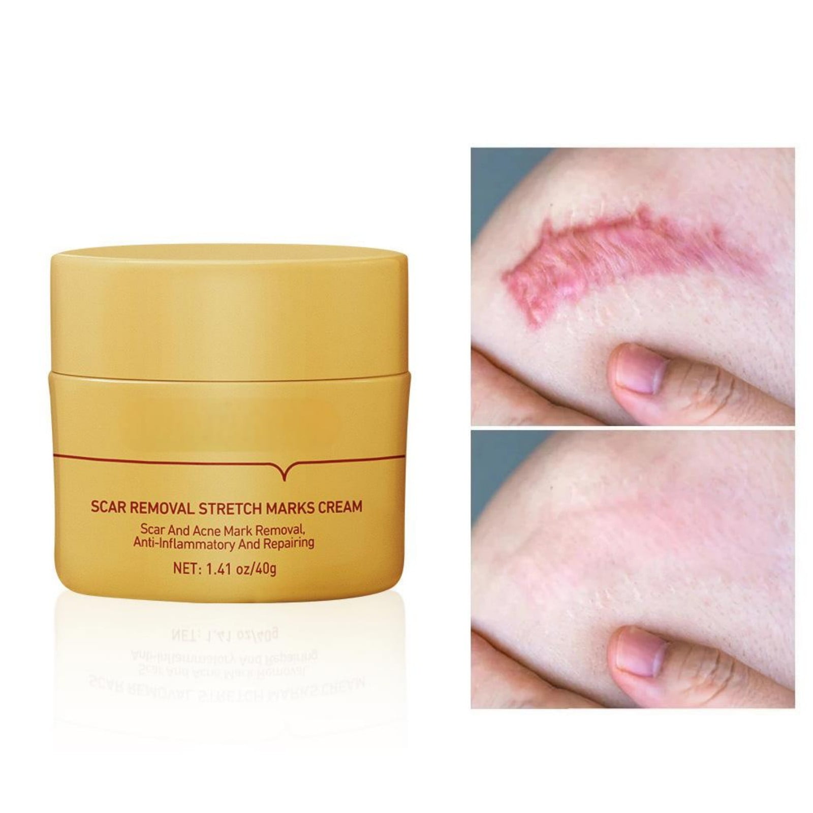 Weerihhol 40g Scar Reduction Natural Ingredients Fade Marks Smooth Skin ...