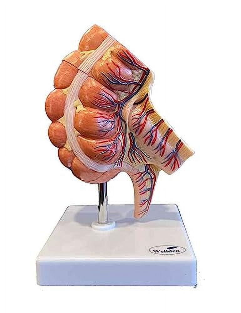 Wellden Medical Anatomical Caecum and Appendix Model, 1.5X Enlarged, 2-Part - Walmart.com
