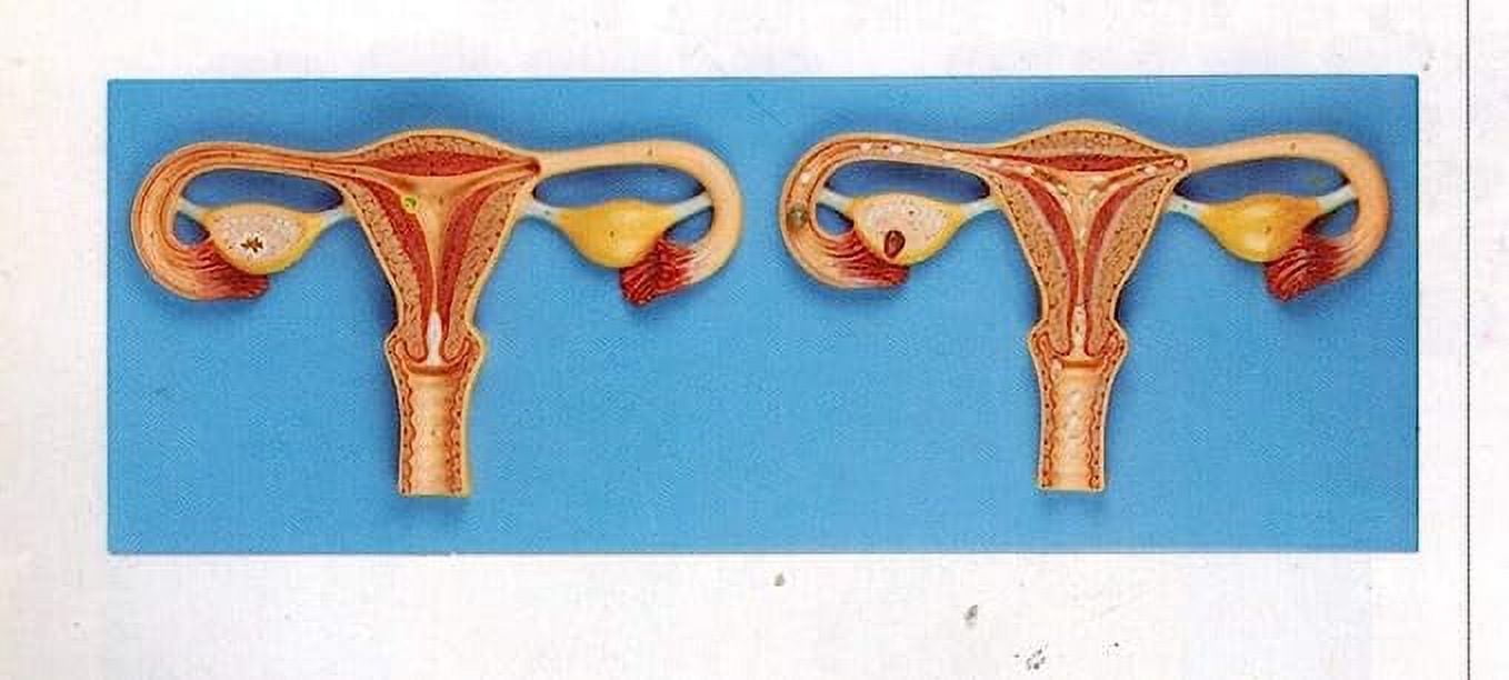 Wellden Medical Anatomical Fertilization Process Model - Walmart.com