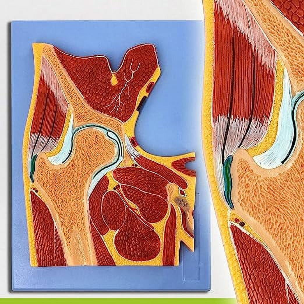 Wellden Medical Anatomical Pelvis Joint Section Model - Walmart.com
