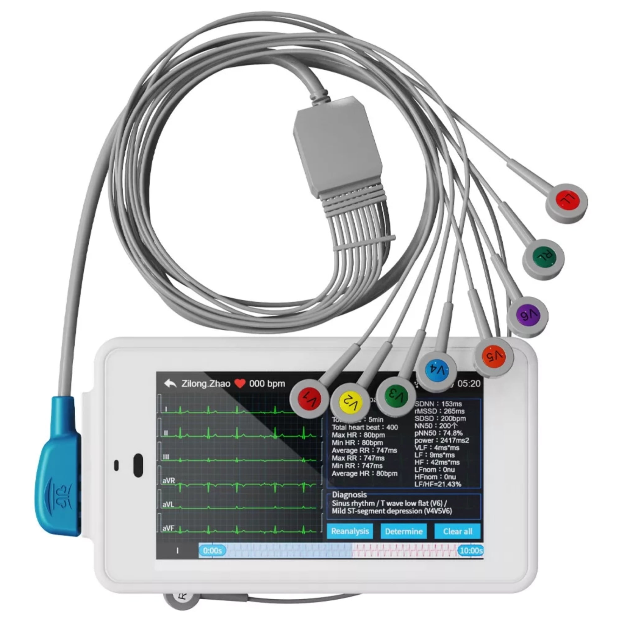 Wellue 6/12-lead Electrocardiograph ECG EKG Machine + Glasgow ECG ...