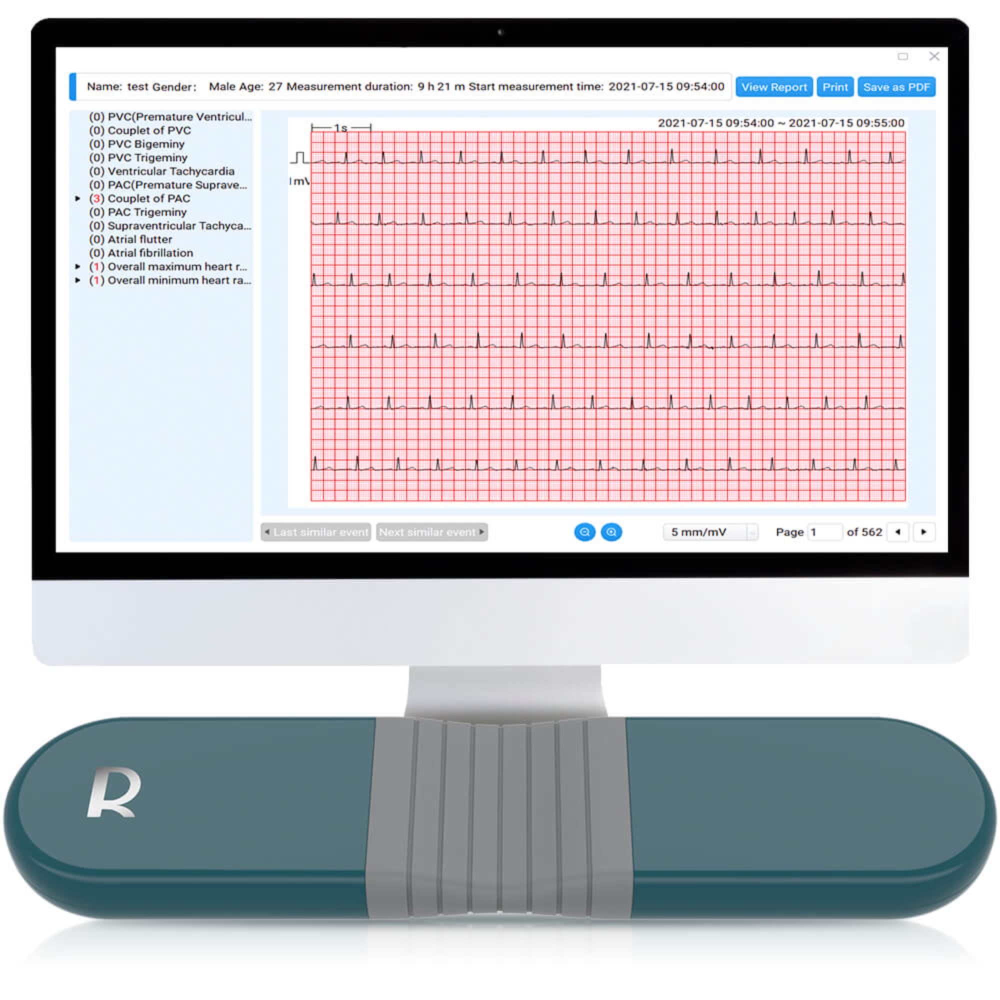 Wellue Heart Health EKG ECG Monitor for Sleep and Exercise,24 Hours ...