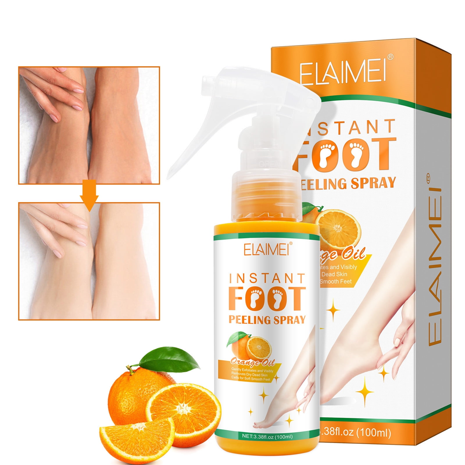 Weloille Foot Peeling Spray,Exfoliating Foot Spray for Remove Dead Skin ...