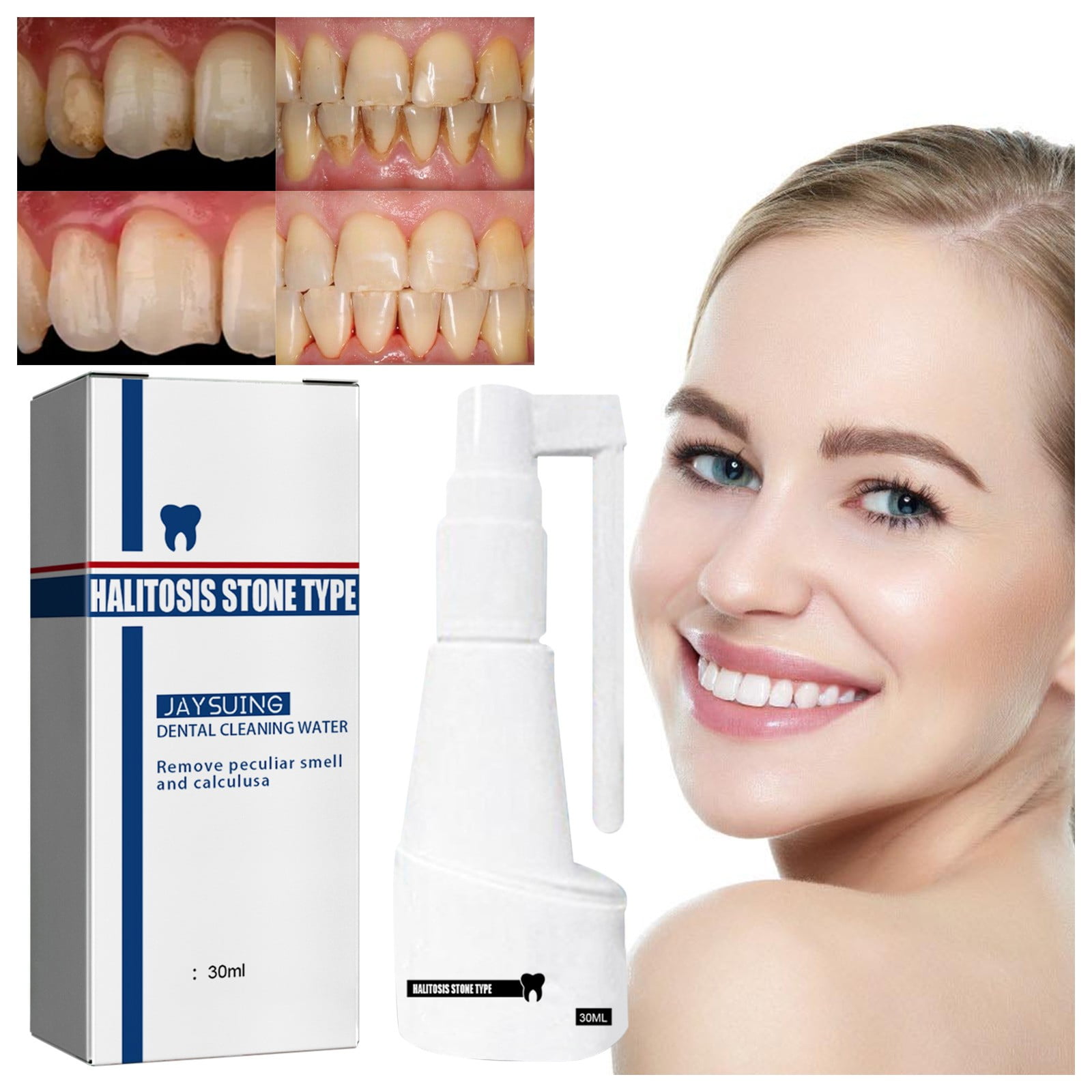 Wentin Calculus Dissolving Spray Household Calculus Remover For Tooth ...