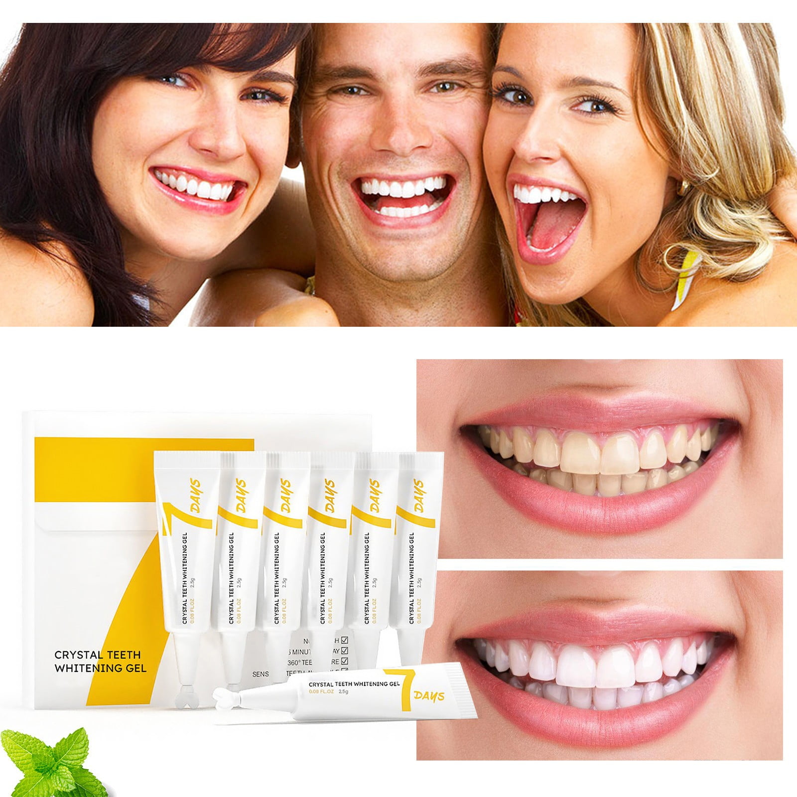 Wentin Gingival Care Liquid Cleaning Tooth Stains Tooth Yellow Care ...