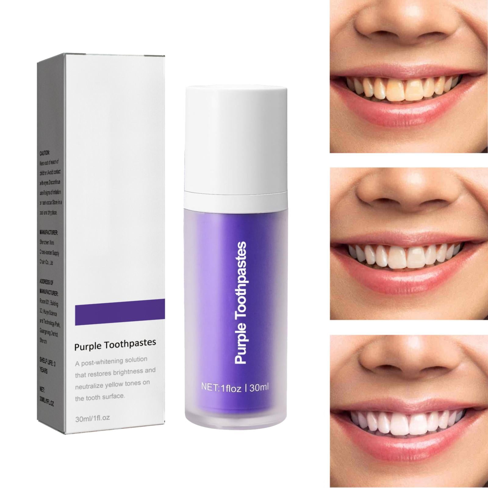 Wentin Toothpaste Clearance! Colour Corrector Tooth Stain Removal Teeth ...