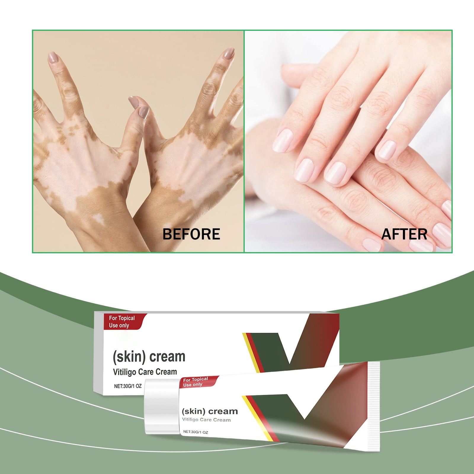 White Care Cream Evens Out Skin Tone And Promotes Melanin To Improve ...
