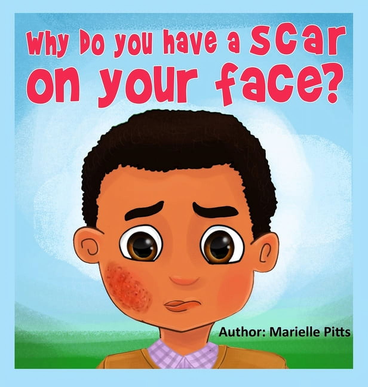 Why do you have a scar on your face?, (Hardcover) - Walmart Business ...