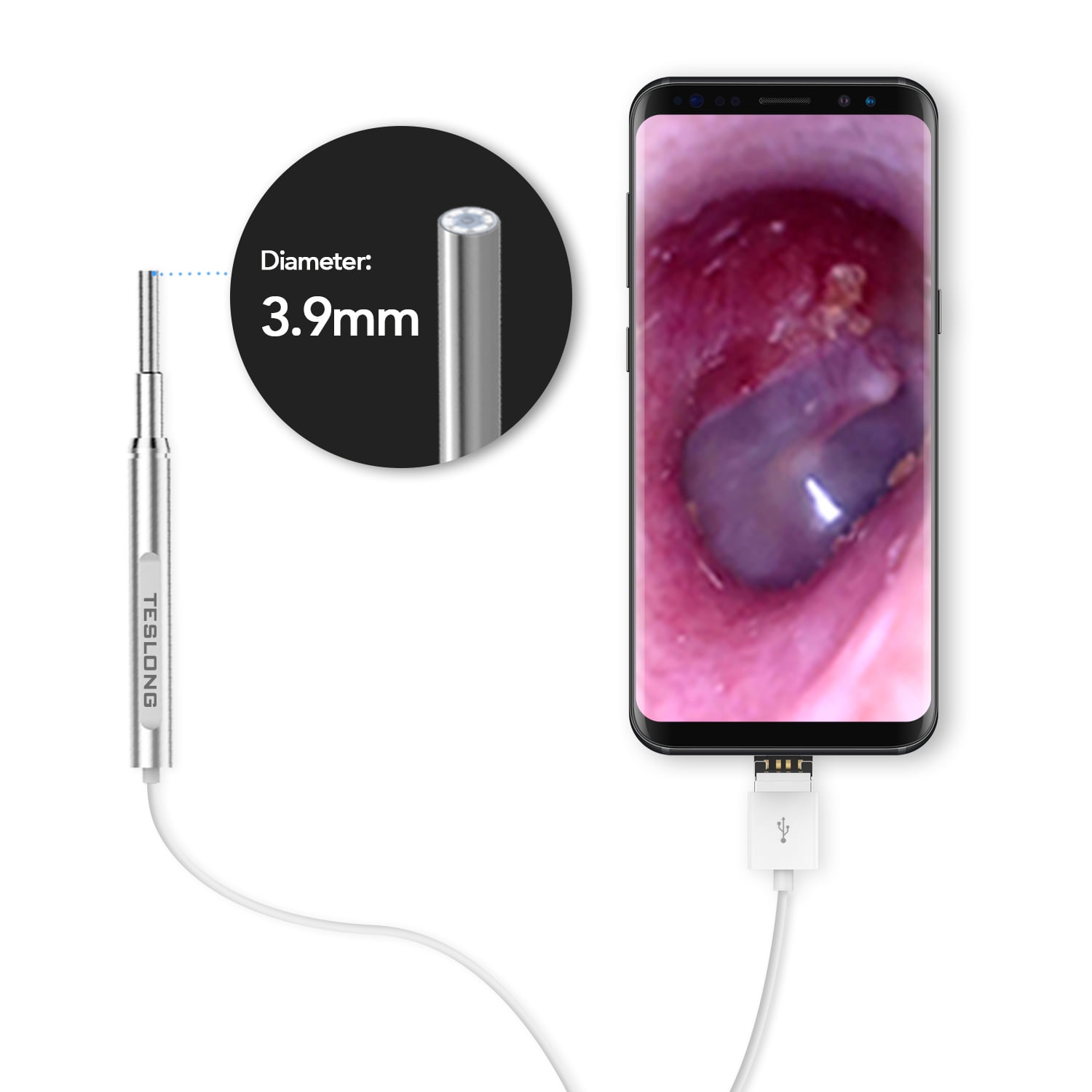 WiFi Otoscope for iPhone & Android, Ear Camera and Wax Removal Tool, 3 ...