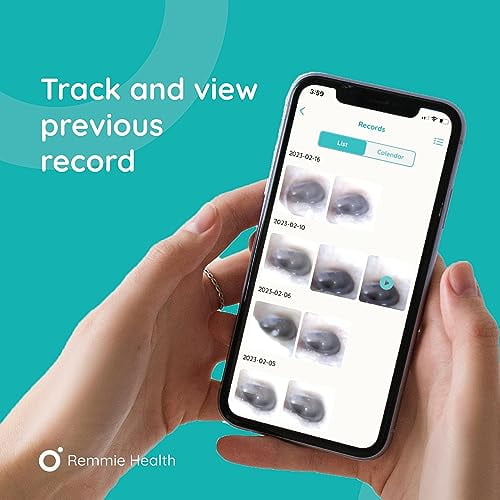 Wireless Otoscope Ear Camera - Remmie Dolphin FDA Registered Wireless ...