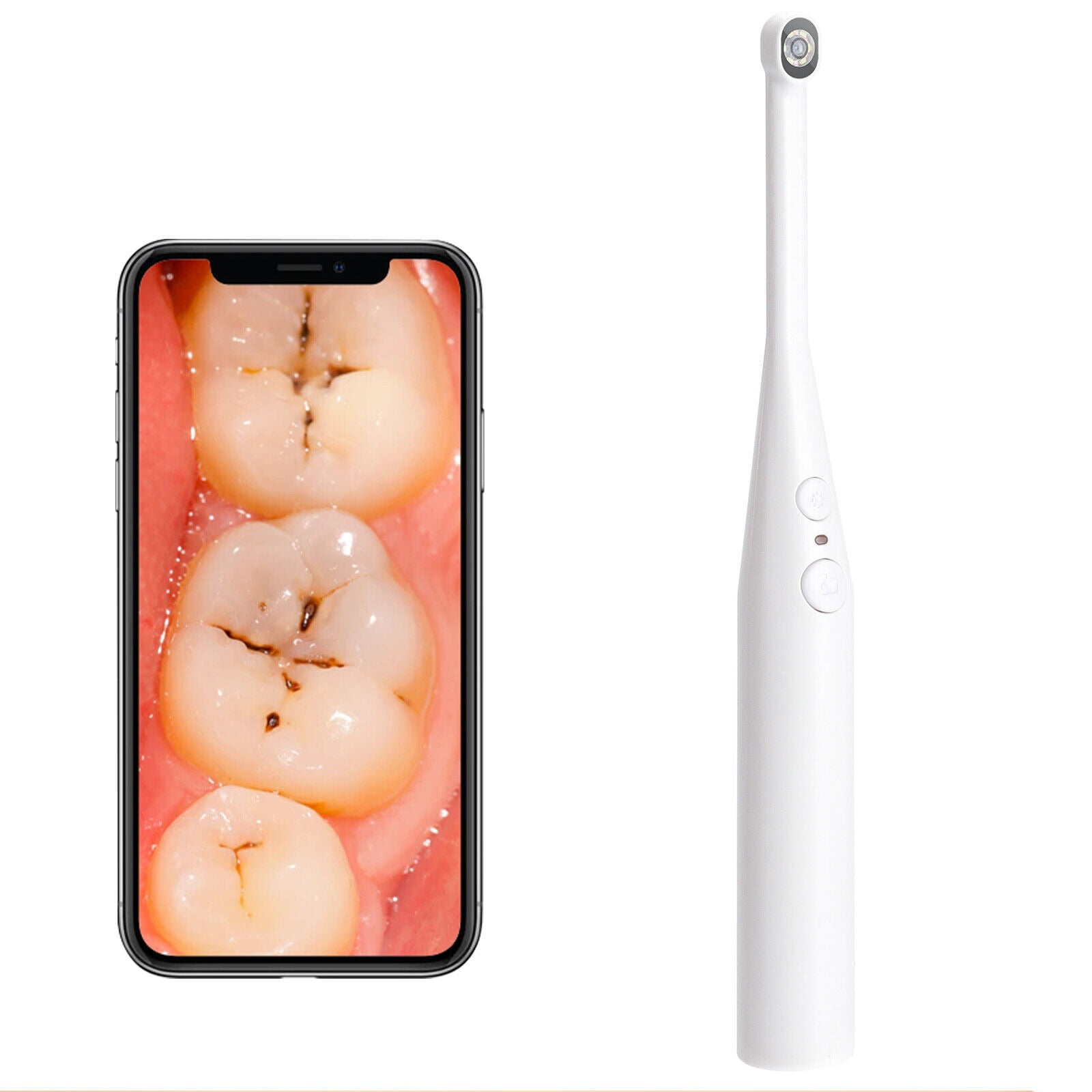 Wireless WiFi Oral Dental Endoscope with 6-LED Adjustable Light ...