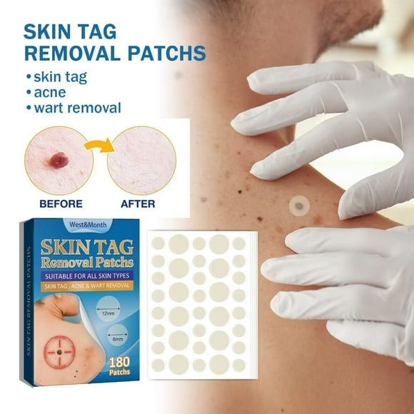 Skin Tag Remover