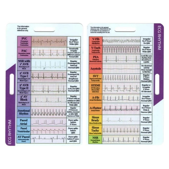 Wiueurtly "/EKG Pocket Card: Quick Reference To Interpreting Heart And Identifying Arrhythmias ...