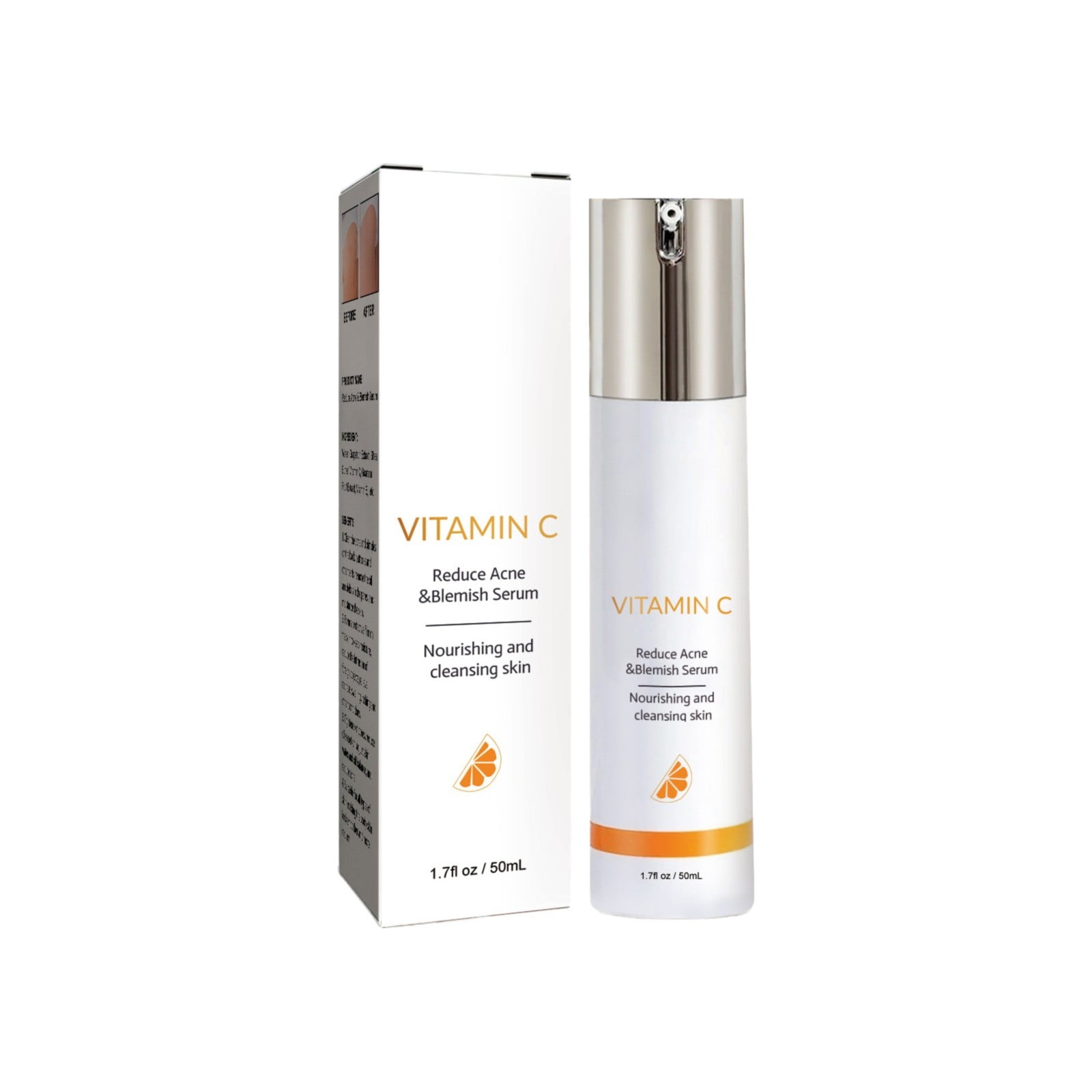 Woaiqiana For Body Fade Moisturizing Smooth Facial Skin Buttock Remover ...