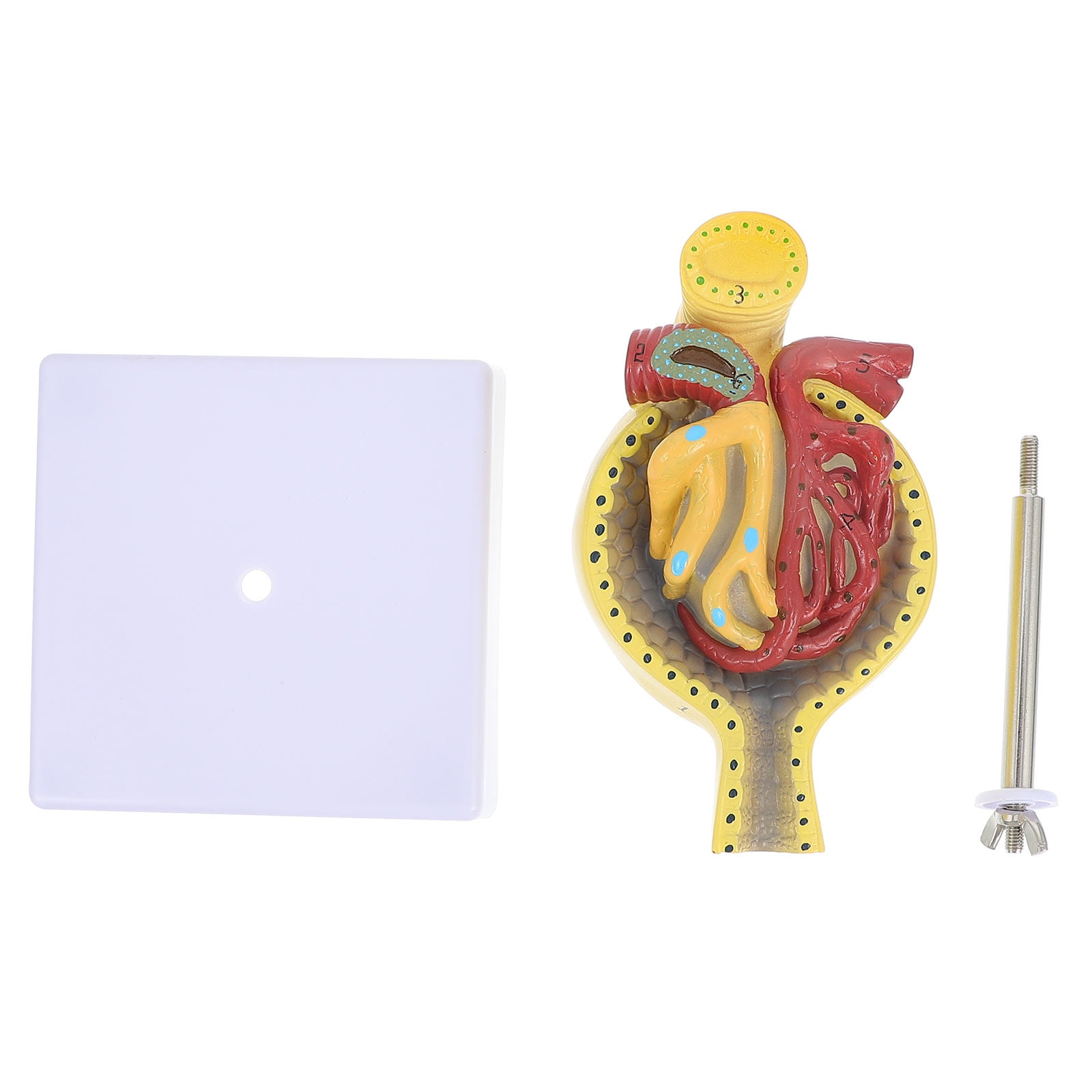 1pc Human Glomerulus Medical Model for Teaching with Base - Walmart.com