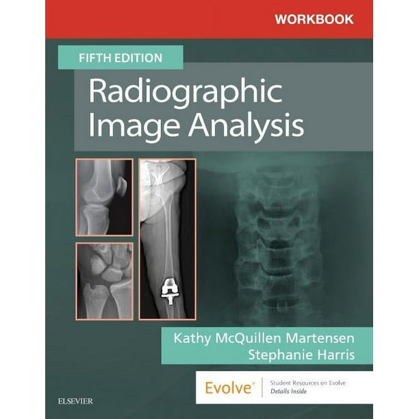 Workbook for Radiographic Image Analysis (Paperback) - Walmart Business ...