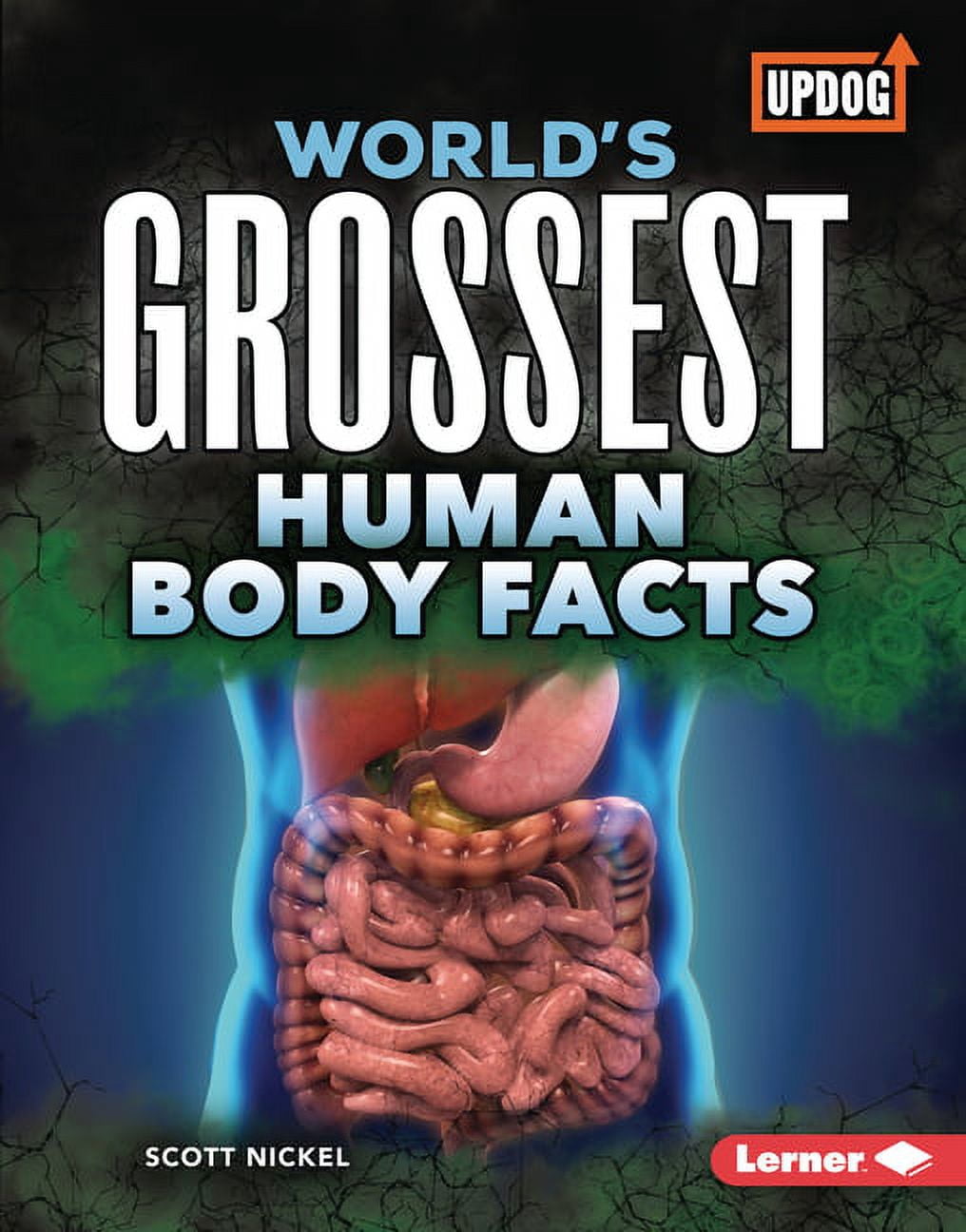 World's Grossest (Updog Books (Tm)): World's Grossest Human Body Facts ...