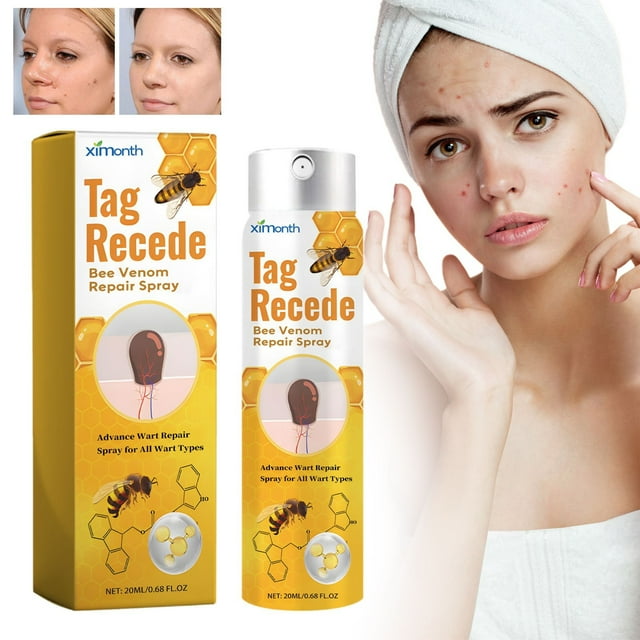 Wuvpotd Body Care,Tag Recede And Tags Spray For All Skin Types Spra ...
