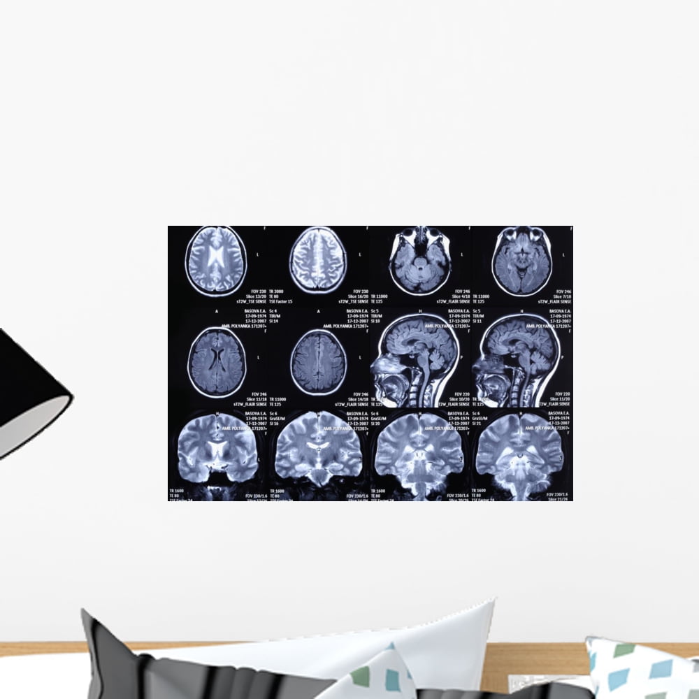 X-ray Picture Brain Wall Mural by Wallmonkeys Peel and Stick Graphic ...