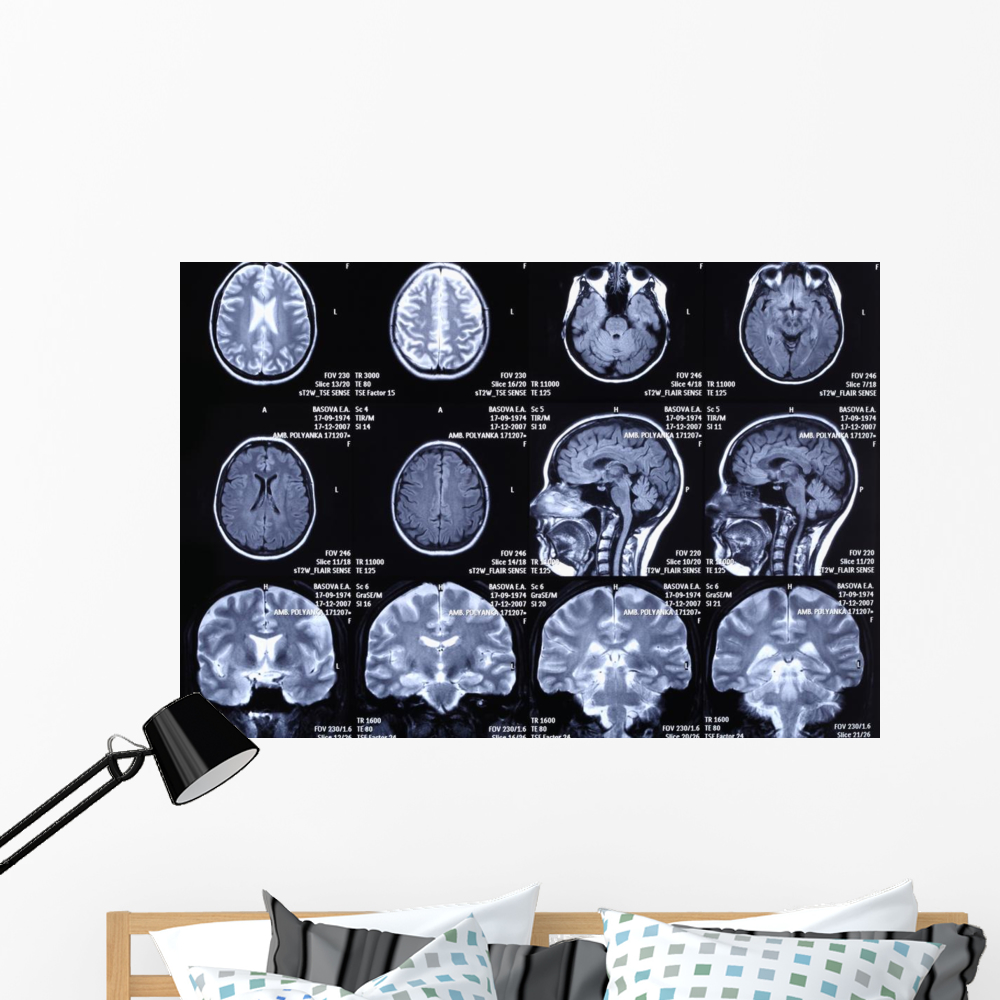 X-ray Picture Brain Wall Mural by Wallmonkeys Peel and Stick Graphic ...