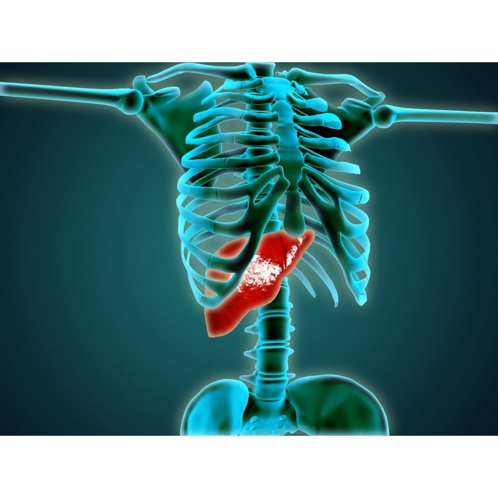 X-ray view of human skeleton with liver Poster Print - Walmart.com