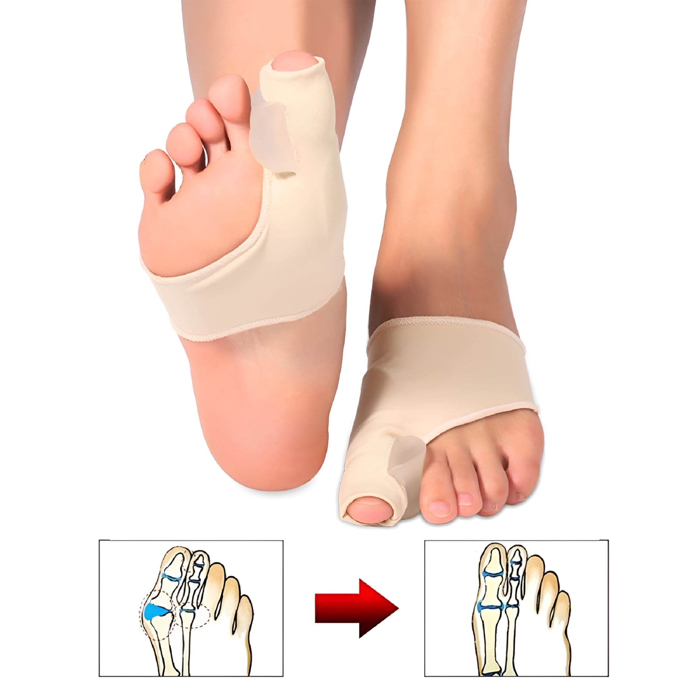XIRQI 1 Pair Silicone Gel Bunion Corrector Big Toe Straightener Bunion ...